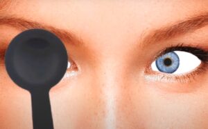 Heterophoria : Symptoms, Causes, Diagnosis and Management