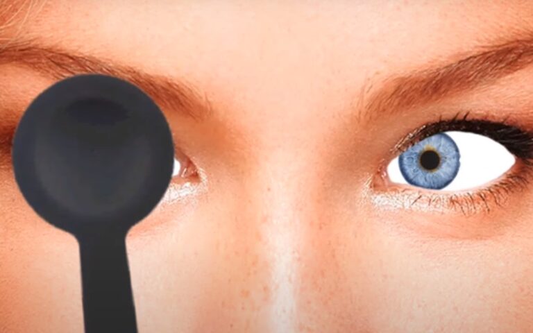 Heterophoria : Symptoms, Causes, Diagnosis and Management